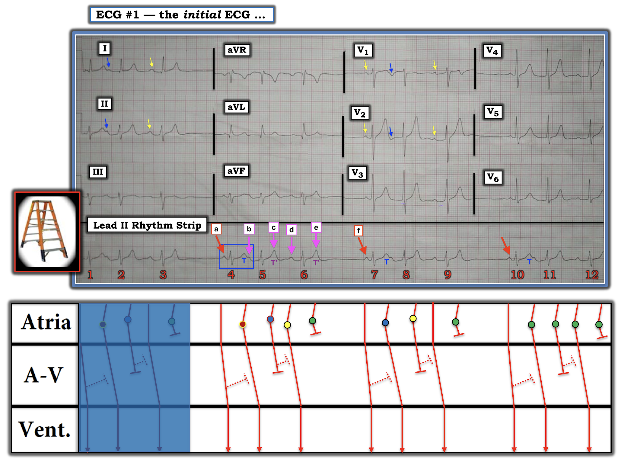Dr. Smith's ECG Blog: September 2020