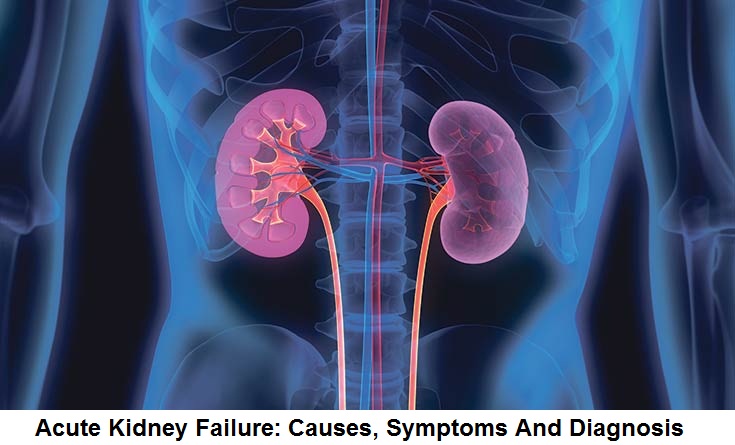 Acute Kidney Failure: Causes, Symptoms And Diagnosis | Health And Beauty