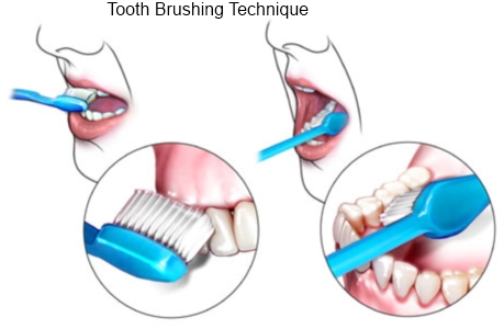 Dr. Sandhya: Know Your Teeth: TOOTH BRUSHING TECHNIQUE