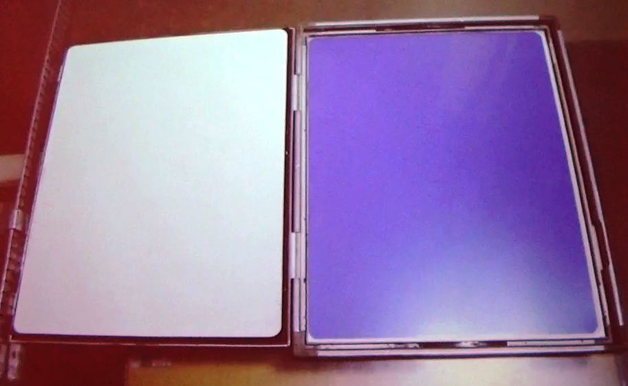 RADIOANATOMIA: PRIMERA CLASE DE RADIOANATOMIA