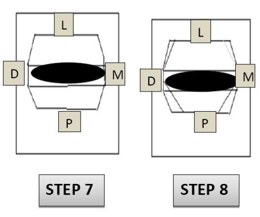 Permanent maxillary central incisors l tooth crown & root morphology ...