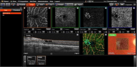 Miranza IOA: LA TECNOLOGÍA MÁS AVANZADA PARA LA EXPLORACIÓN Y ...
