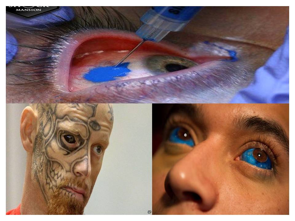 top 10 most extreme bizarre body modifications | best top 10