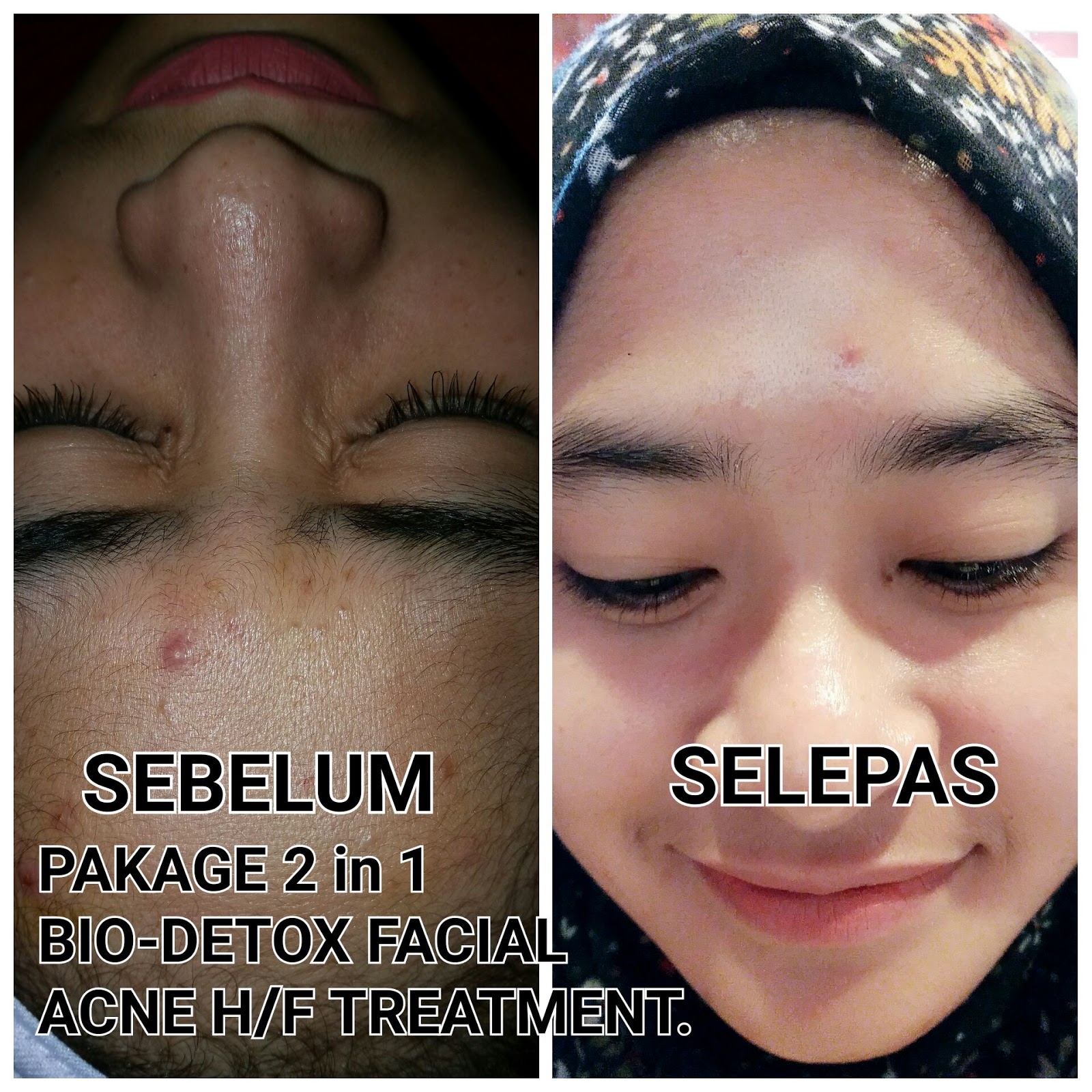 PAKAR RAWATAN RESDUNG MUAR: May 2018