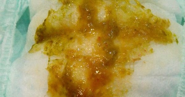 Prof. Dr. Ulysses Fagundes Neto - Gastroenterologia Pediátrica e ...