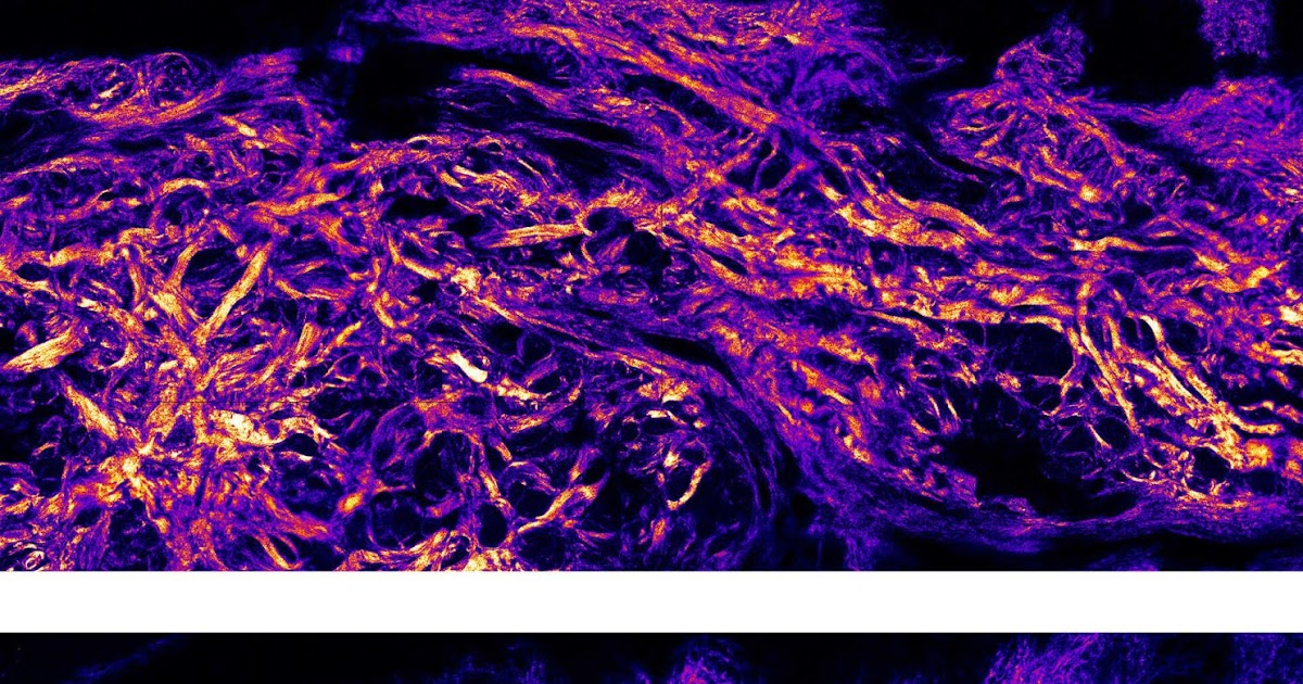 The birth of Modern Man: How skin cells from foot soles could help ...