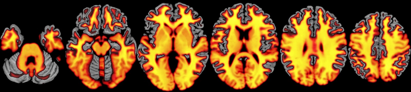 The Cognitive Axon: How to make a zombie brain