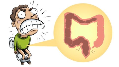 Constipation causes, symptoms and management details