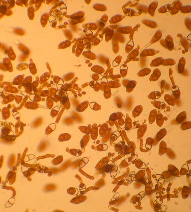 Tree Fruit Disease Update: Scab and rust infection period Apr 12-13