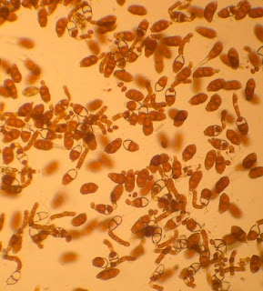 Tree Fruit Disease Update: Scab and rust infection period Apr 12-13