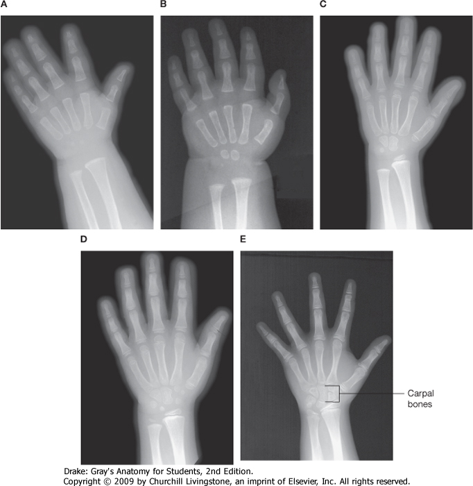 Body System: SKELETAL SYSTEM