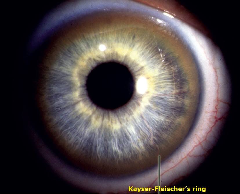 Ophthalmology Notes: SPOTS & DOTS in Ophthalmology