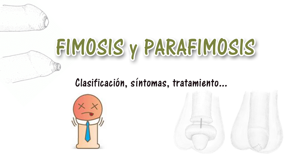 Fimosis y parafimosis ~ Salud y bienestar