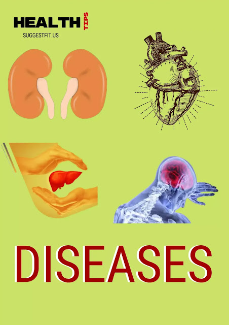 rare diseases list and symptoms - suggest fit