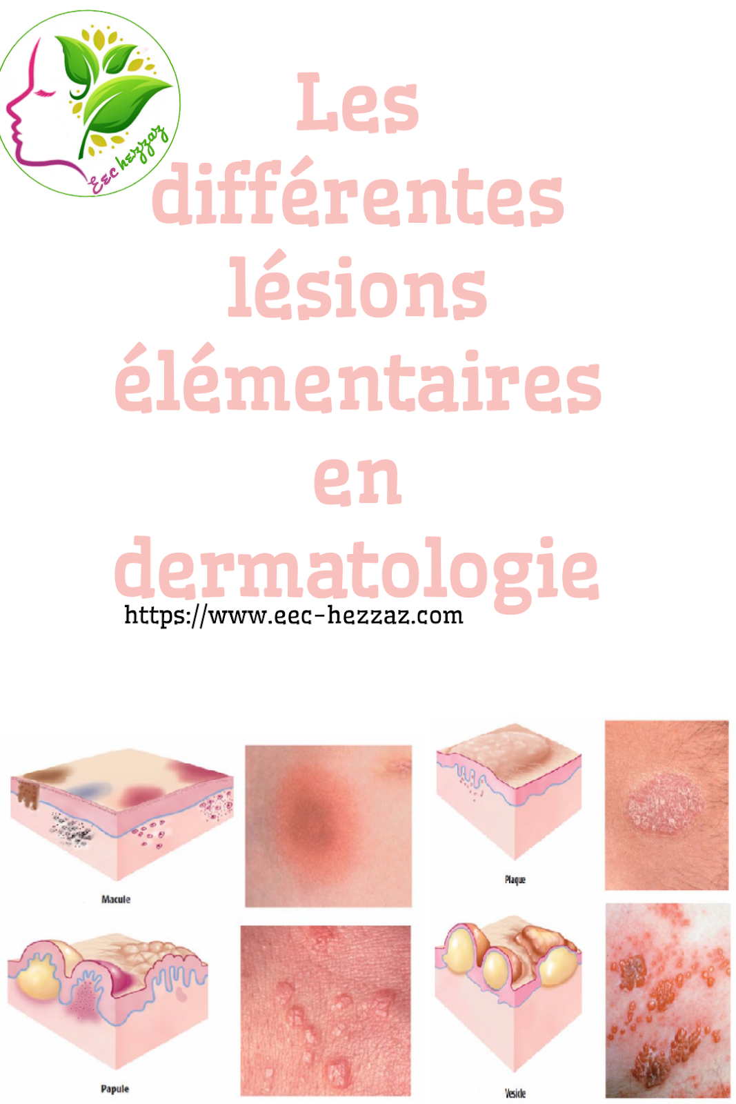 Les différentes lésions élémentaires en dermatologie