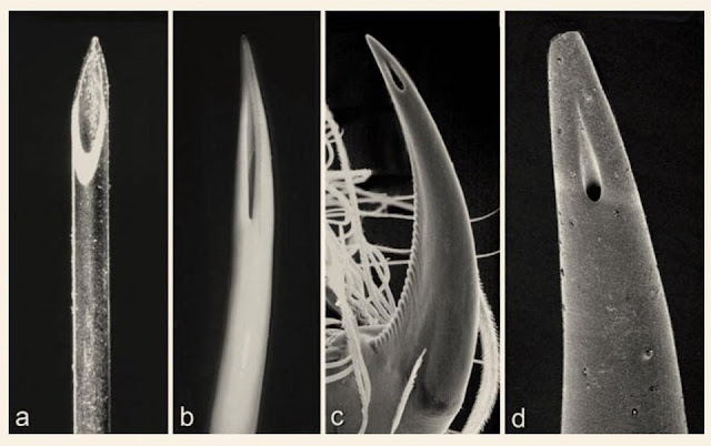 TYWKIWDBI ("Tai-Wiki-Widbee"): Biologic needles