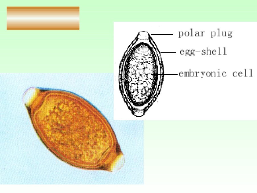Myblog Myworld: Trichuris trichiura