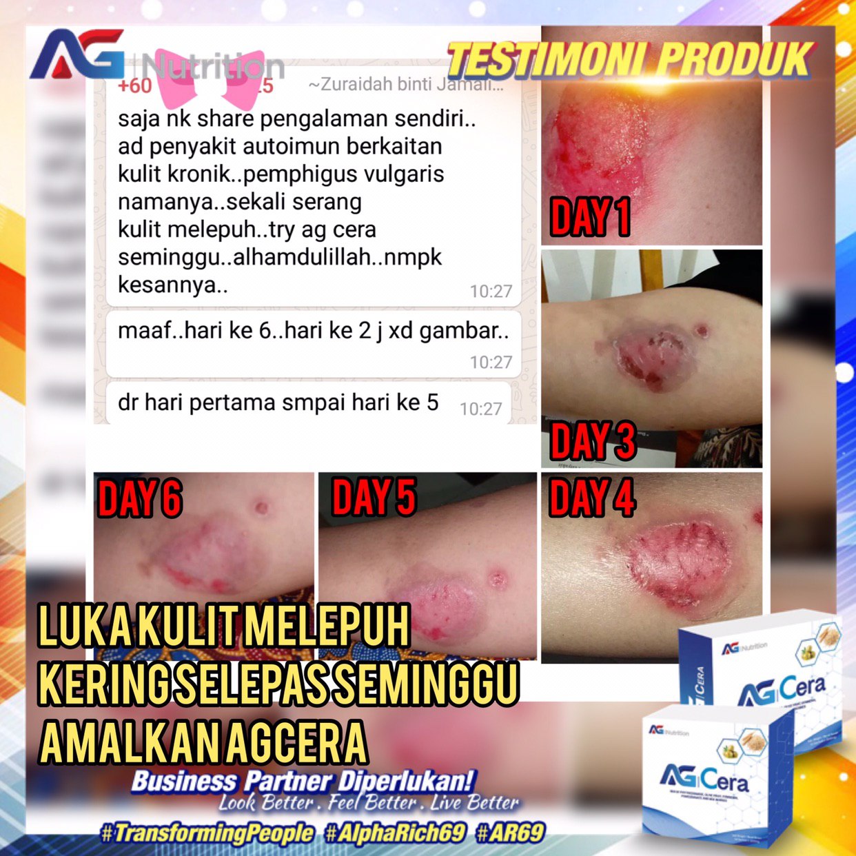 AG CERA | SUPLEMEN ANTI OKSIDAN TERBAIK DI DUNIA | KEMBALI SIHAT DAN ...