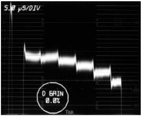 ANEKA INFO TEKNIK: PAL SYSTEM TELEVISION MEASUREMENT : DIFFERENTIAL GAIN