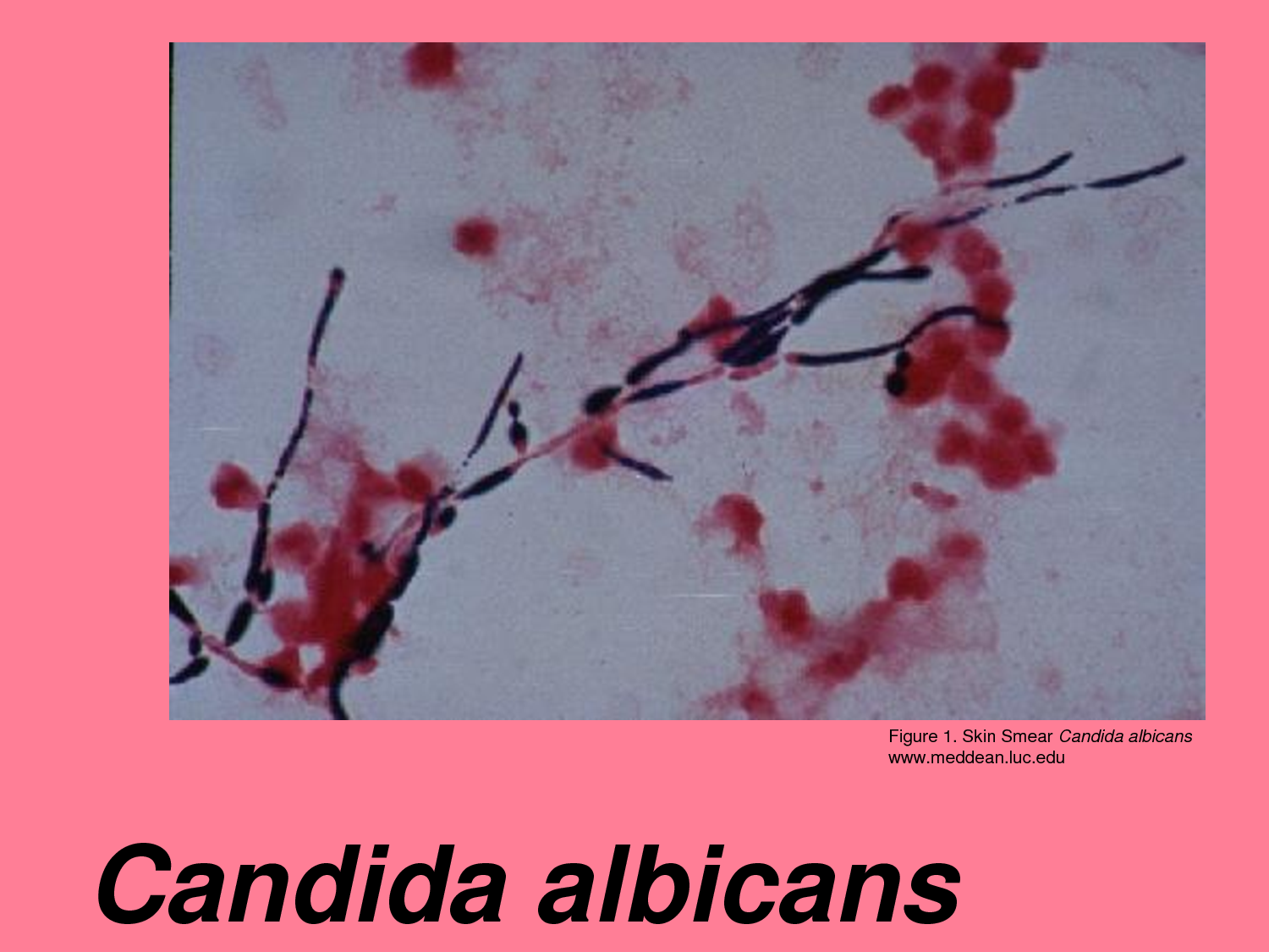 Ketahui punca masalah gatal di kawasan faraj - Oh kiji | Sumber Bacaan ...