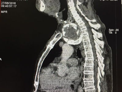 EL RINCÓN DE LA MEDICINA INTERNA. juanpedromacaluso@yahoo.com.ar ...