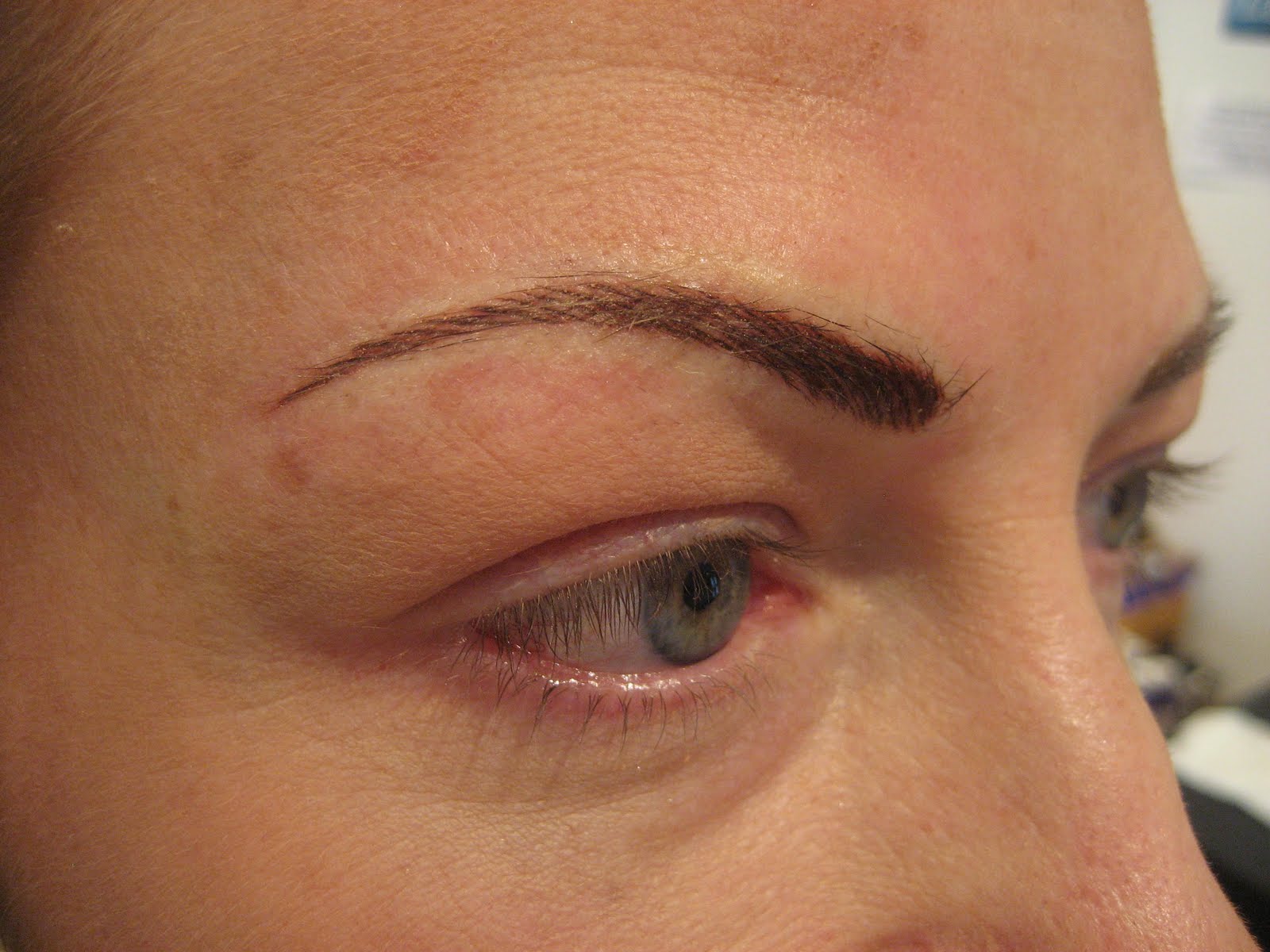 Image Perfect: Eyebrow Shape & Restoration Before & After