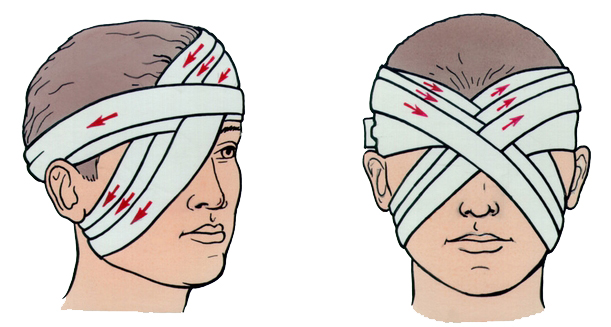 ATENSALUD: Enfermaría Geriátrica y Sociosanitaria: Técnicas de Vendaje
