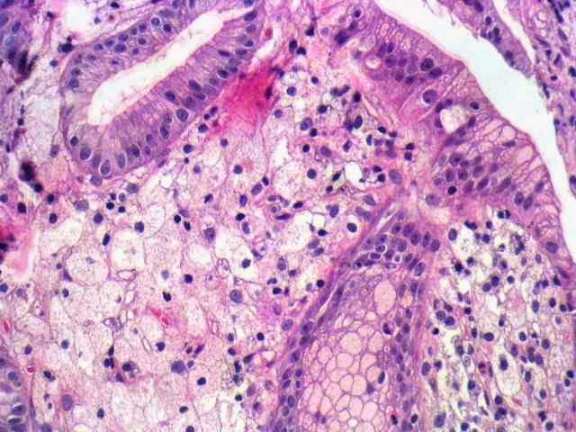 GASTROINTESTINAL AND LIVER HISTOLOGY PATHOLOGY ATLAS: STOMACH GASTRIC ...