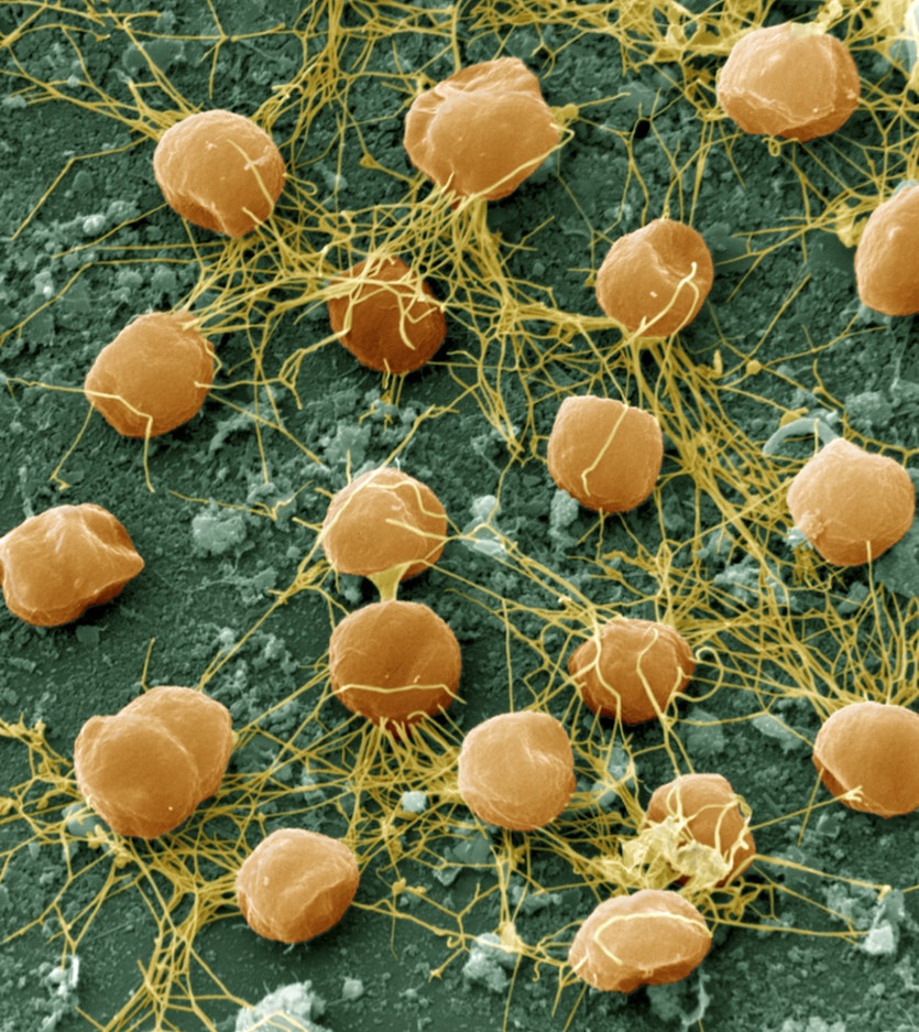 Qu'est-ce qu'un microbe?