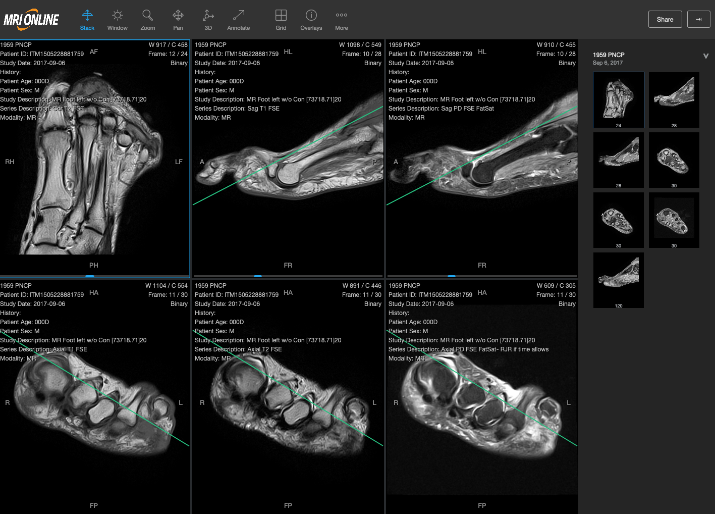 Radiologia en Internet: MRI Online - Free Cases