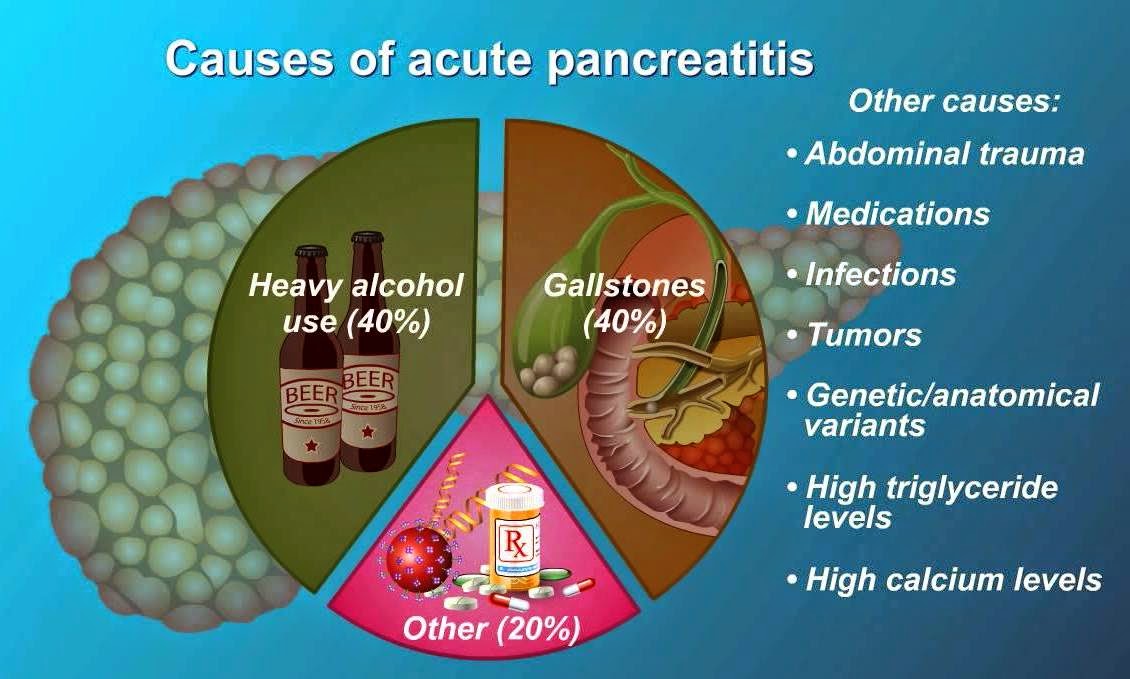 The Health Website : Acute Pancreatitis (Acute Inflammation of the ...
