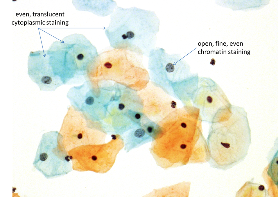mltshiksha.blogspot.com: PAP Staining (Cytolog - Papanicolaou Staining)