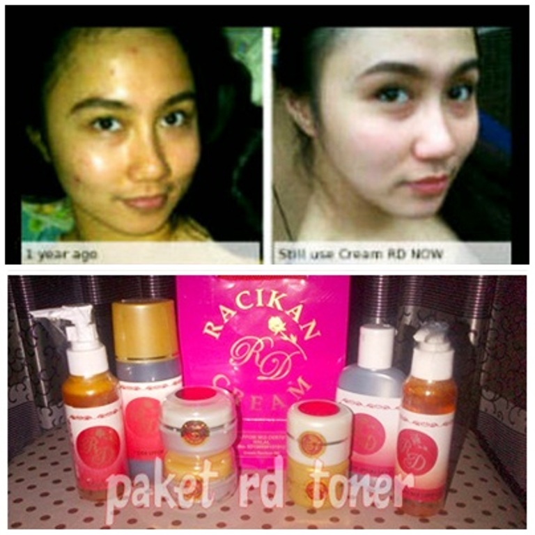 PERAWATAN CANTIK ARTIS: CREAM RD ORI TERMURAH IJIN BPOM HALAL KULIT ...