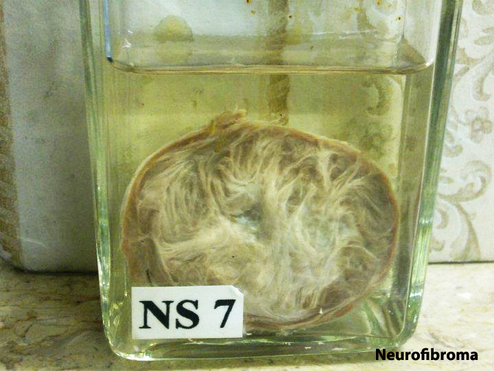 Medical Education for Students: Gross Specimens General Pathology (50 ...