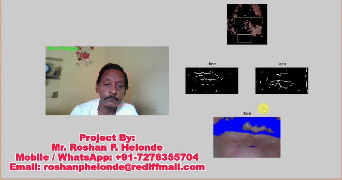 Real Time Driver Drowsiness Detection Using Matlab Project With Source
