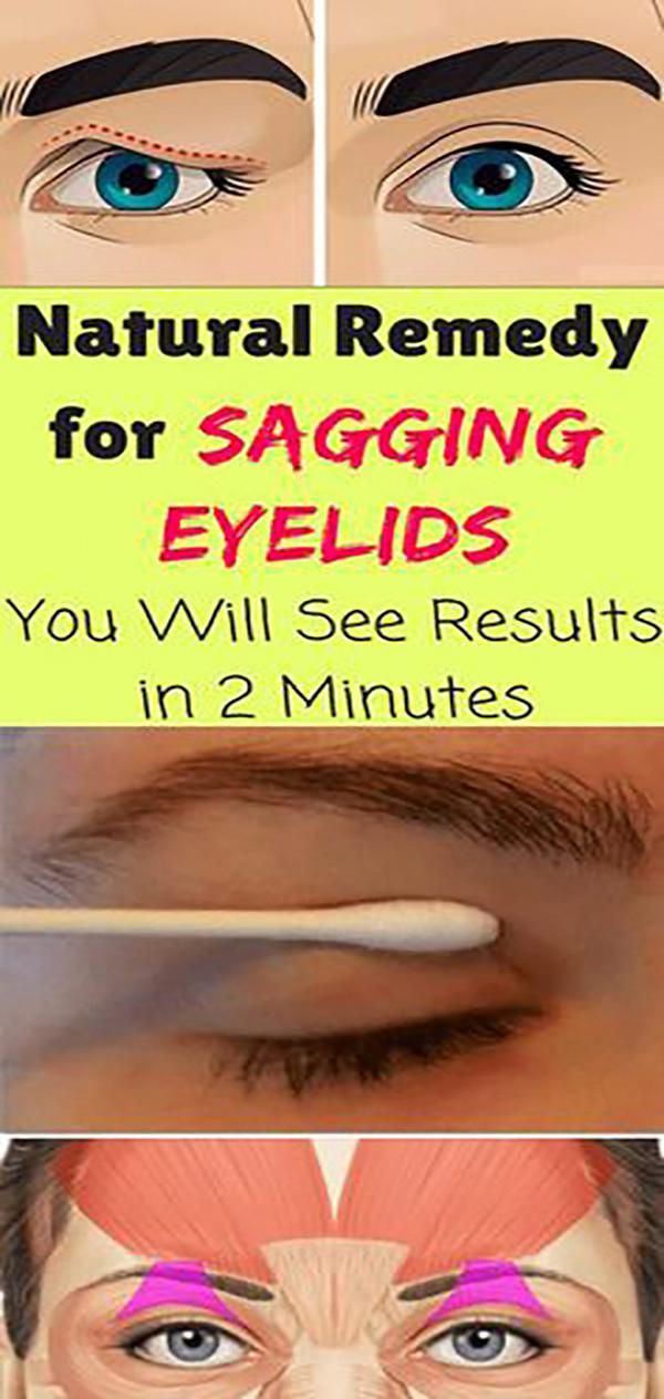 Natural Remedy For Sagging Eyelids You Will See Results In 2 Minutes ...