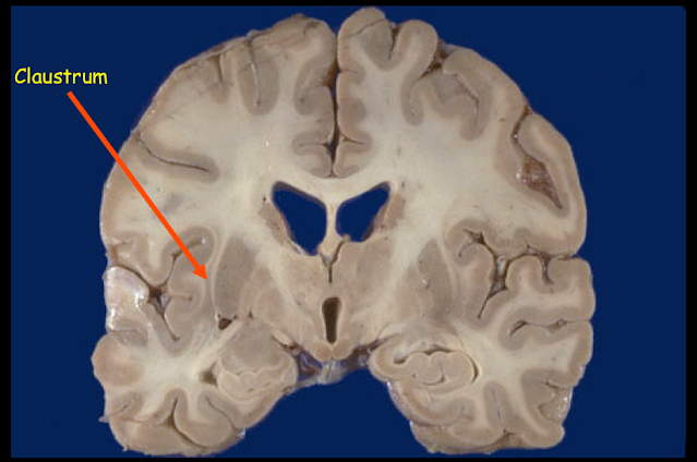 WAKE UP! A Neural Basis of Enlightenment?