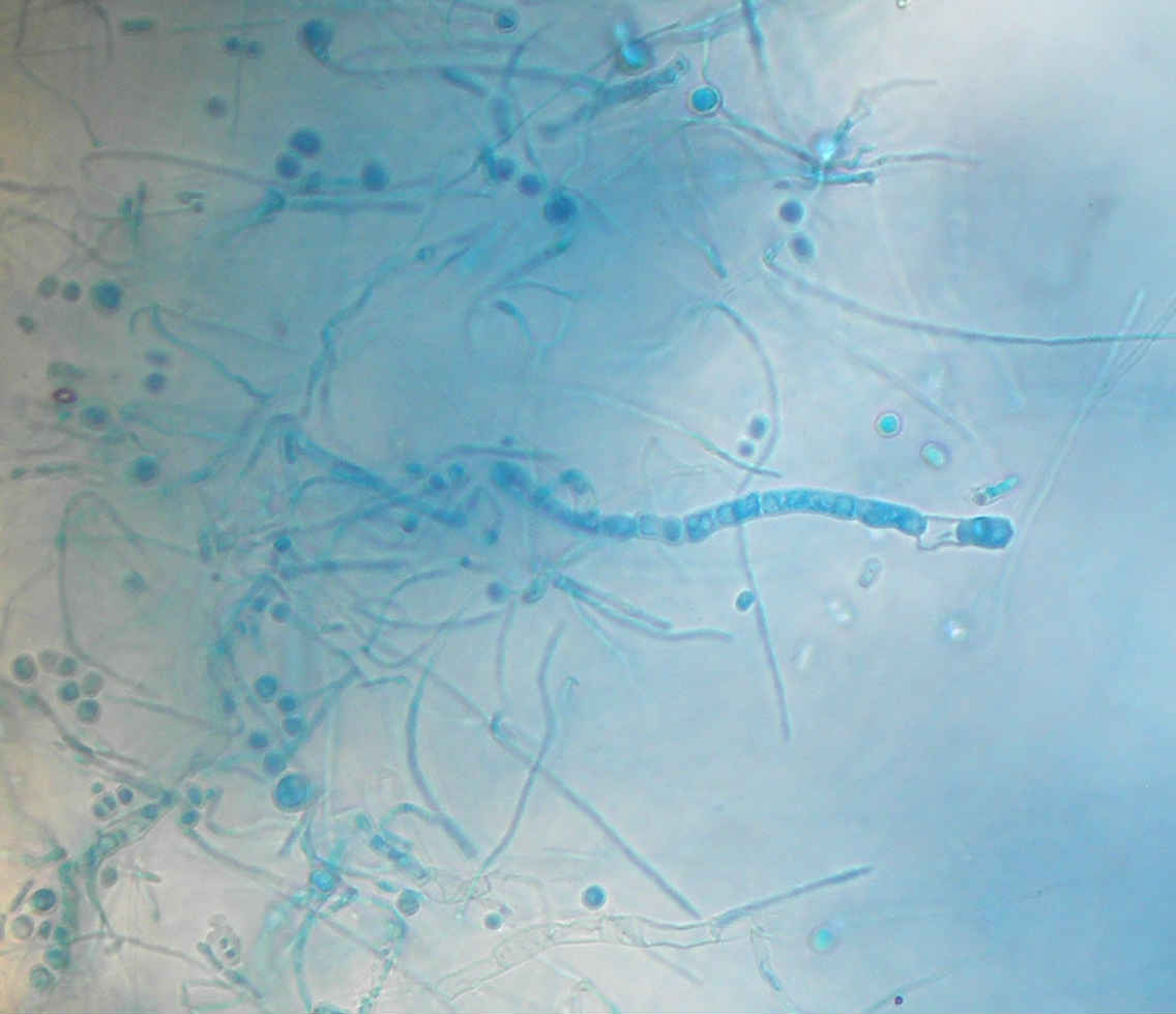 ATLAS MICOLOGIA: NEOSCYTALIDIUM HYALINUM