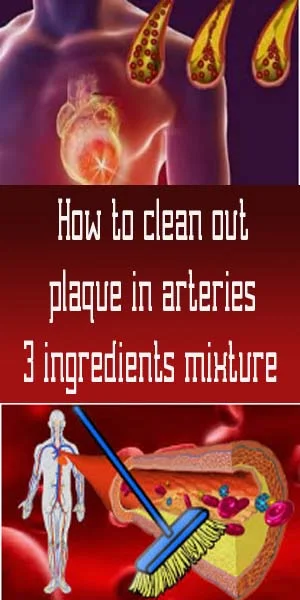 How to clean out plaque in arteries 3 ingredients mixture - Healthy ...