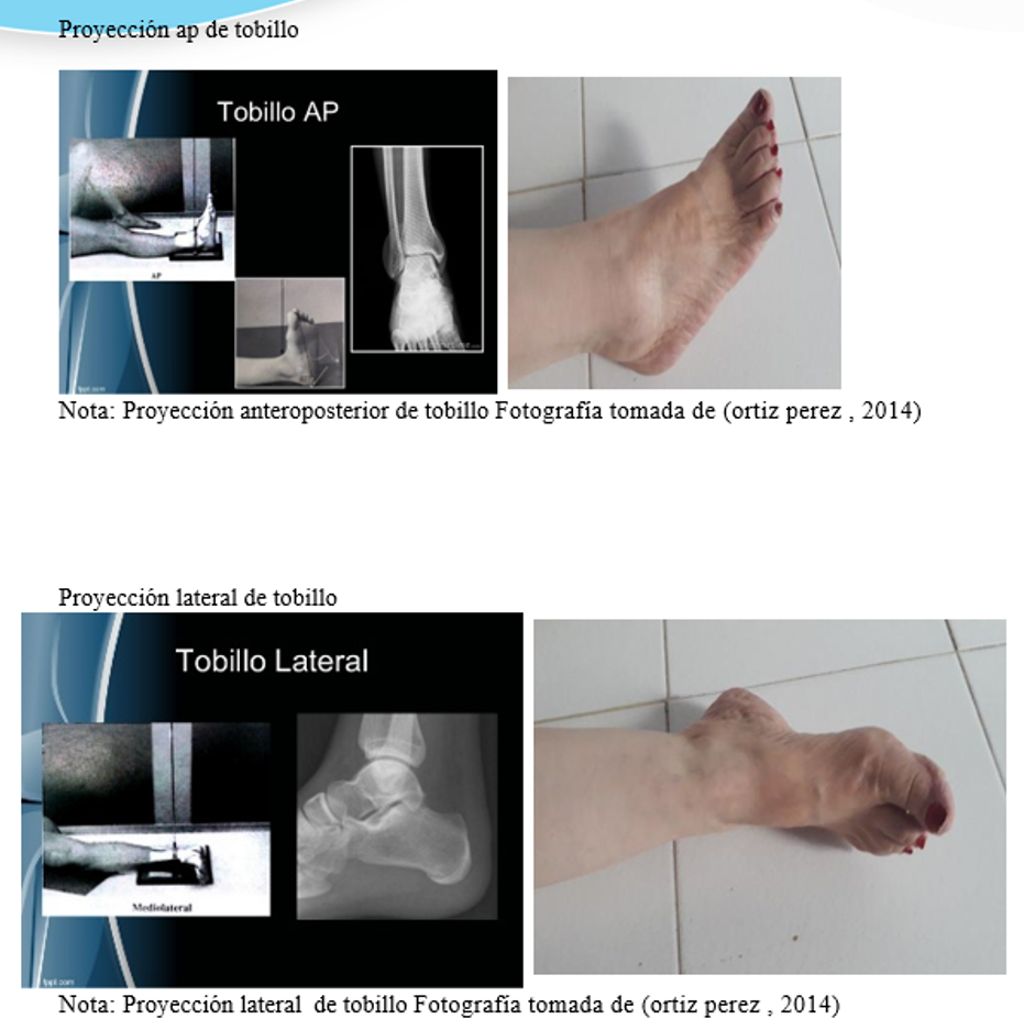 CREACION DE PROTOCOLOS : ESTUDIOS RADIOGRAFICOS MIEMBROS INFERIORES