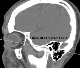 PROTOCOLOS DE TOMOGRAFIA COMPUTARIZADA