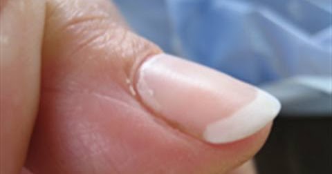 Pro Nail Tech Training: Enhancement Troubleshooting: Lifting nails