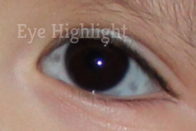 How To Remove Dark Grey Black And Brown Spot On Sclera Eyeball 2022 how-to-remove-dark-grey-black-and-brown-spot-on-sclera-eyeball-2022