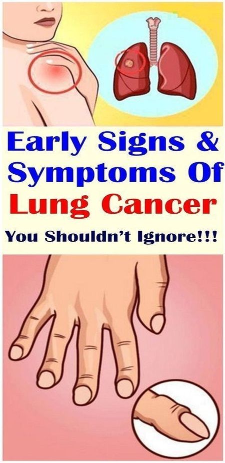 7 Warning Signs Of Lung Cancer Not To Ignore Healthy High