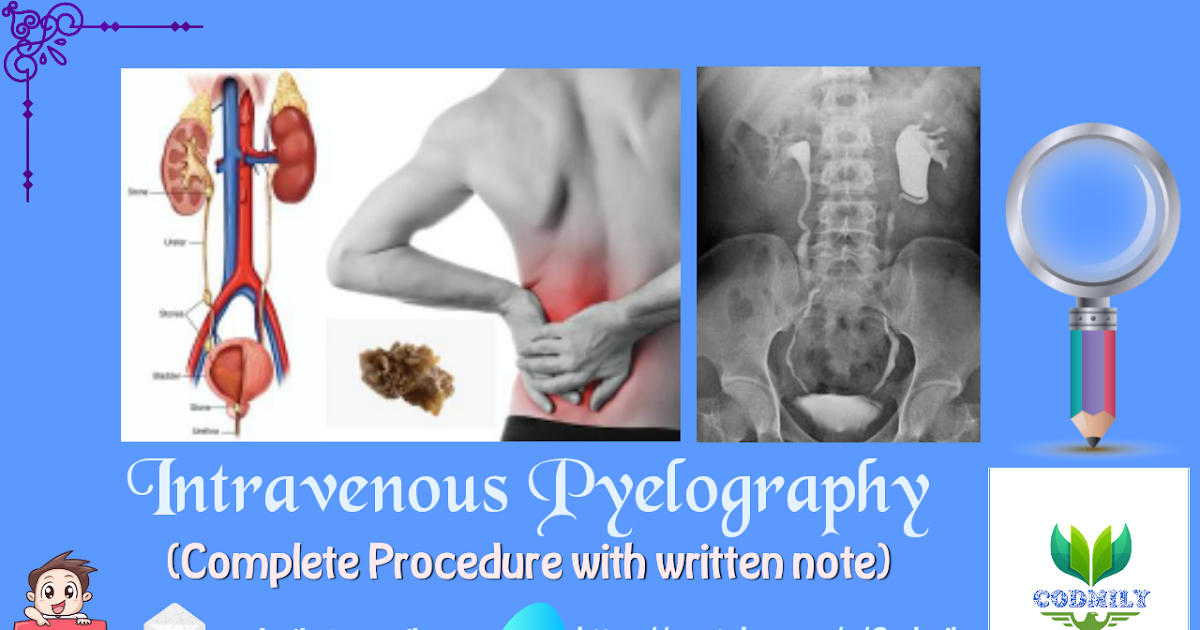 The Radiological Educational Network 26: Intravenous Pyelography