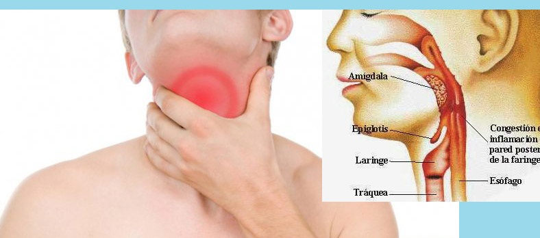 Info Kesehatan - Penyakit Faringitis