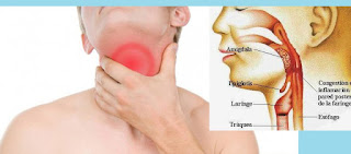 Info Kesehatan - Penyakit Faringitis