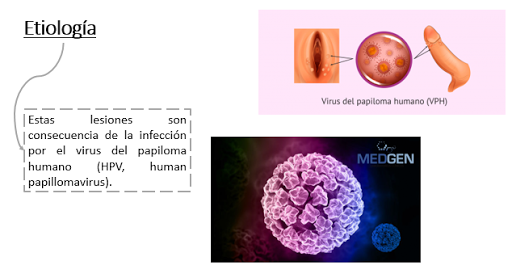 Condilomatosis