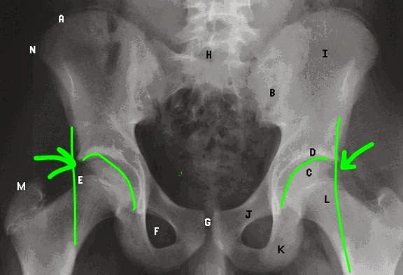 THIS I KNOW | a mommy blog about our son with special needs: 11/9/14 ...