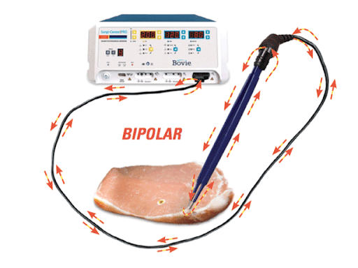 The Site for Healthcare Professionals: Electro Surgical Unit (ESU).